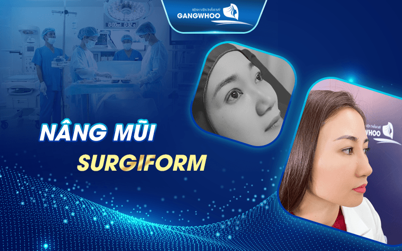 Nâng Mũi Surgiform - Giúp Dáng Mũi Cao Đẹp Hoàn Hảo