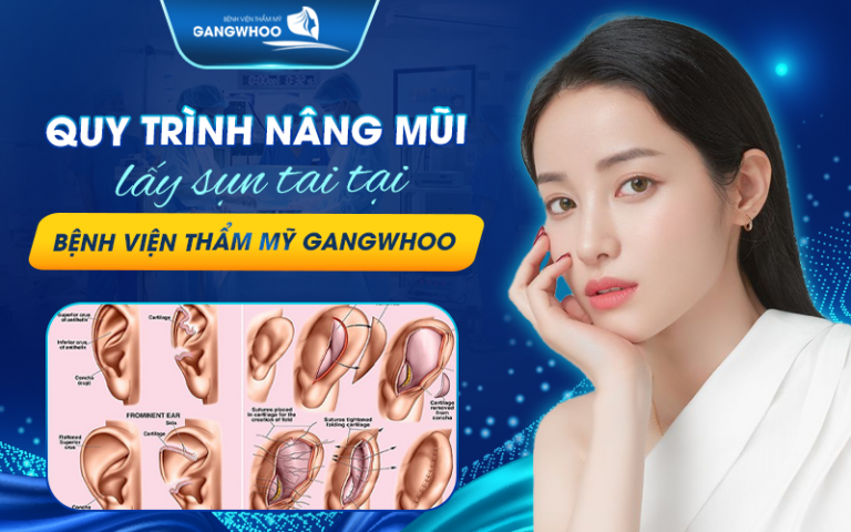 Nâng mũi lấy sụn tai có tốt không? Những thông tin từ chuyên gia